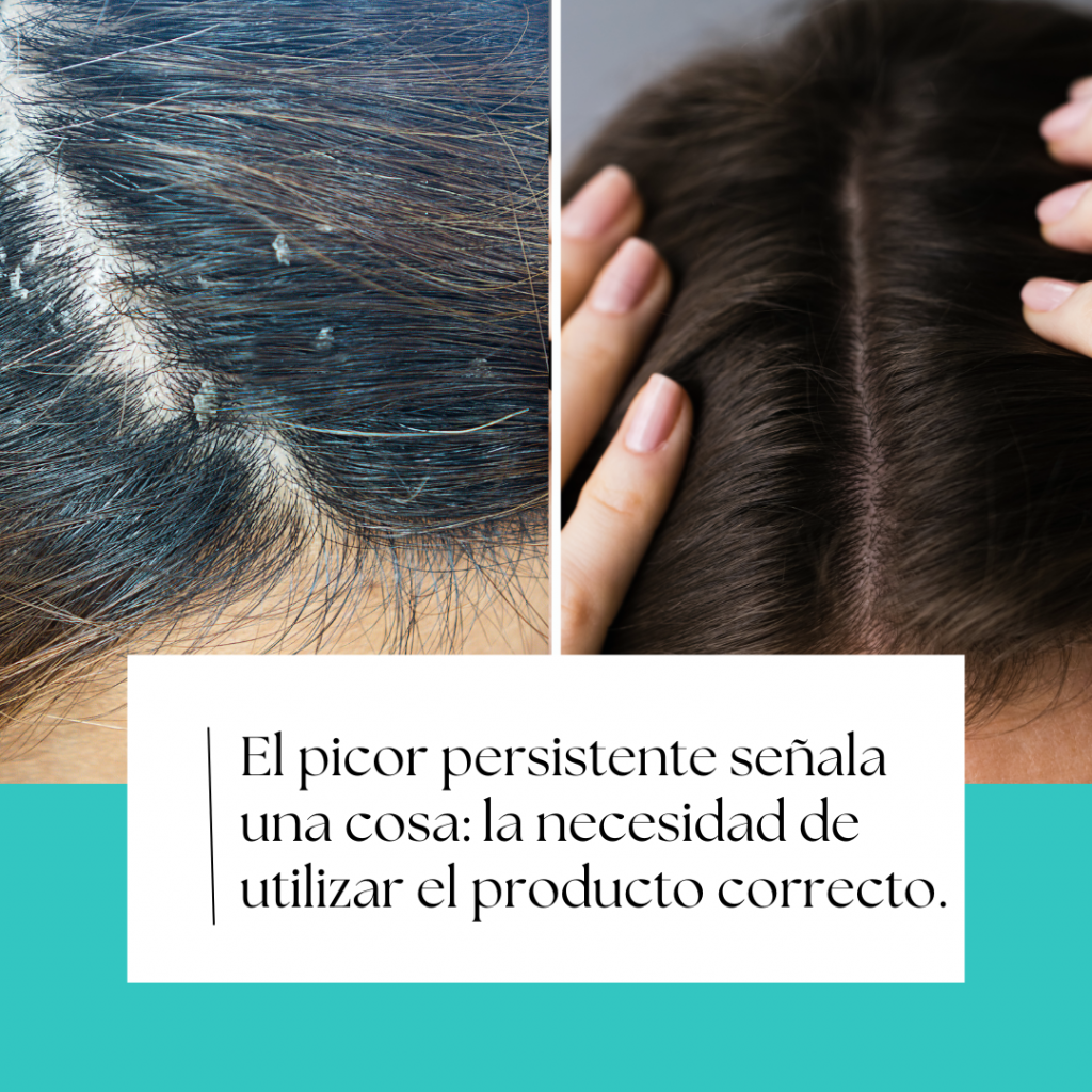Todas las claves sobre el Picor del cuero cabelludo